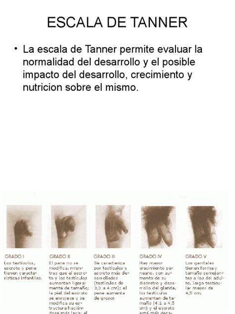 Escala De Tanner 22 Pdf