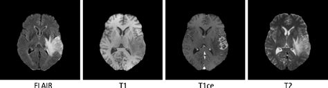 Figure 1 From Selective Deeply Supervised Multi Scale Attention Network For Brain Tumor