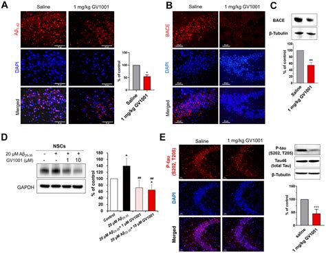 Gv1001 Reduces Neurodegeneration And Prolongs Lifespan In 3xtg Ad Mouse Model Through Anti Aging