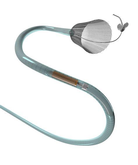 Medtronic Receives Fda Approval For Pipeline Flex Embolization Device