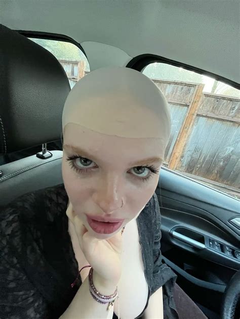 Am I Balding Am I Balding Balding At A Glance