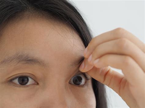 Lazy Eye Causes And Treatment In Adults How To Manage