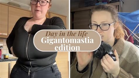 Gigantomastia What Is Macromastia From Youtube