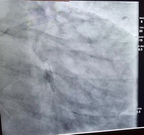 Пациент кај кој во текот на вчерашниот ден со брза дијагностика кардиоваскуларен преглед и