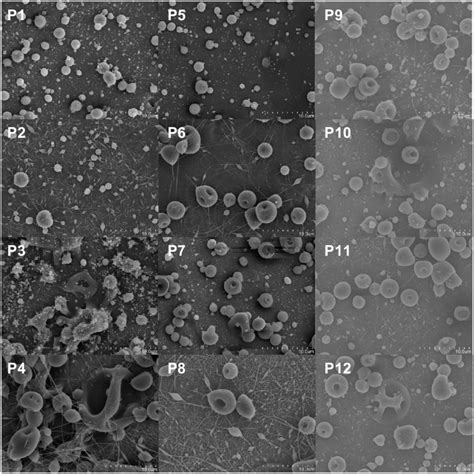 SEM Micrographs Of The Formulations Prepared By EHDP For The Design Of Download Scientific
