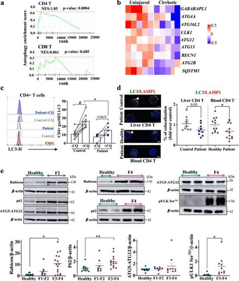 Defective Autophagy In Cd4 T Cells Drives Liver Fibrosis Via Type 3