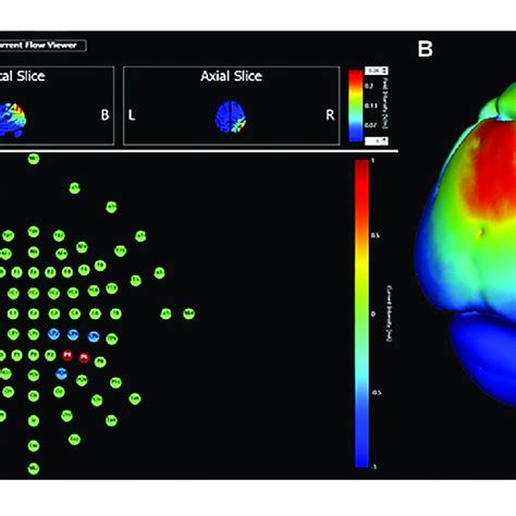 Transcranial Direct Current Stimulation Tdcs Targeting The Right Download Scientific