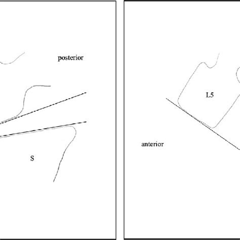 Measurement Of The Gliding Angle A And The Sagittal Rotation B In Download Scientific