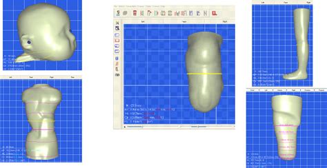 CAD CAM Technology With Rodin D Boston O P
