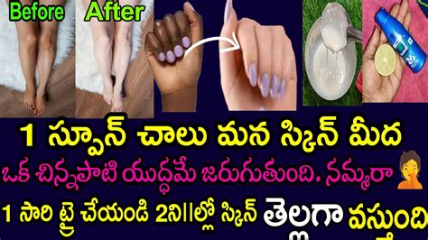 1 స్పూన్ చాలు ఎంత నల్లగా ఉన్న స్కిన్ కూడా 2ని౹౹ల్లో తెల్లగా వస్తుంది