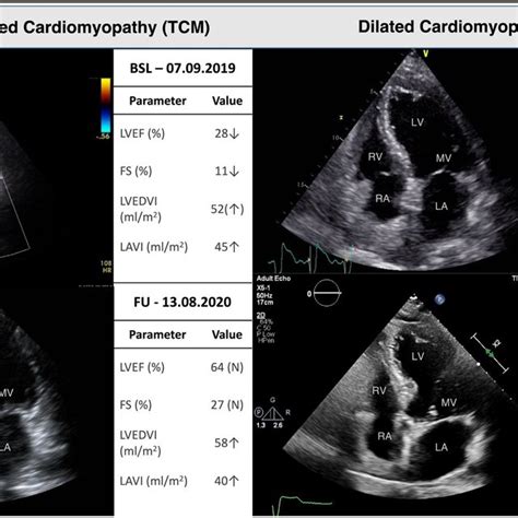 Flutter auricular típico antihorario Download Scientific Diagram