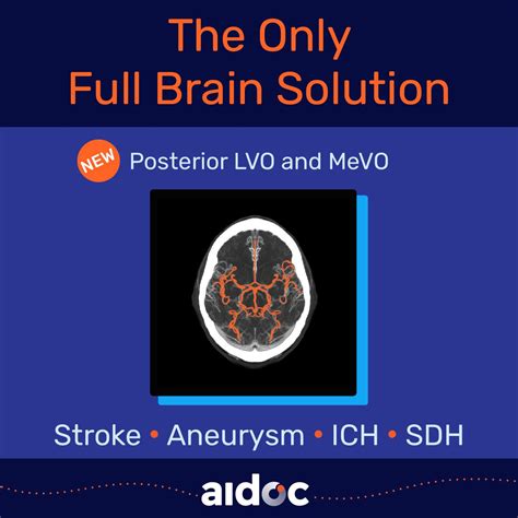 Aidoc On Linkedin Aidoc Introduces The First Ai Solution For Suspected