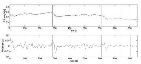 Original RR Interval Sequence And Its Drift Estimated By The Download Scientific Diagram