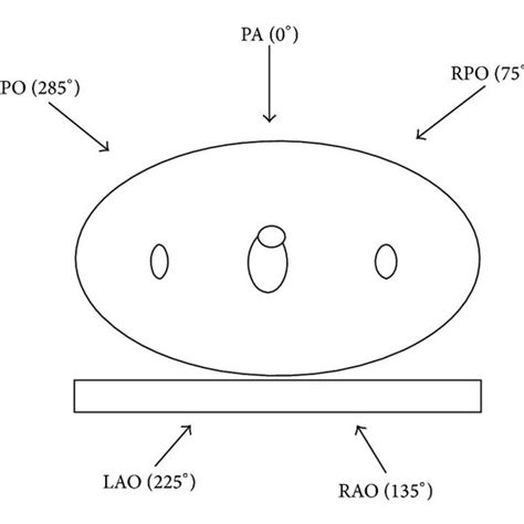 Mlc Leaf Position Check From Tps A And Verification Using