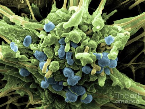 Platelet 12 By Science Photo Library