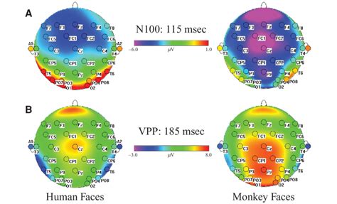Topographic Head Plots Using A Spherical Spline Interpolation Of The Download Scientific