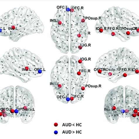 Correlation Between Abnormal Brain Functional Networks And Clinical Download Scientific