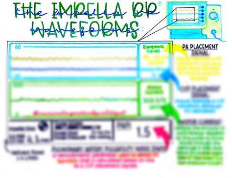 The Impella Rp® And Waveforms Etsy