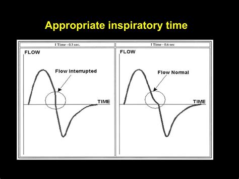 Basics On Mechanical Ventilation Ppt