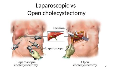 Topic Medical Imaging Operative Cholangiographyppt