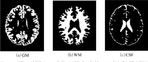 Figure 16 From Classification Of Mri Brain Images Using Dna Genetic