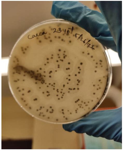 Clostridium Perfringens Colony