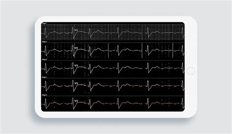 Computer Vision System For Ecg Computer Vision In Medical Imaging