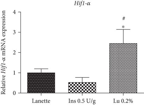 Gene Expression Rt Qpcr Of Nf κb A Ki 67 B Egf C Vegf A D