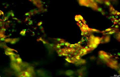 3d Multi Cell Type Liver Organoids Of Non Alcoholic Fatty Liver