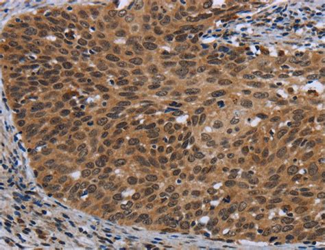 Anti C Ebp Delta Cebpd Antibody Rabbit Anti Human Polyclonal Lsbio