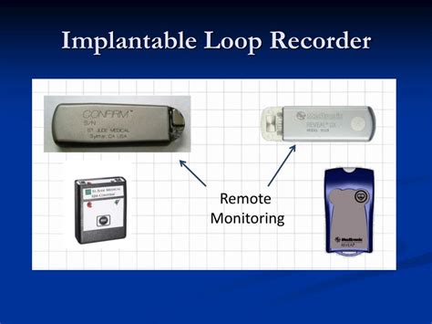 Ppt Evaluation And Management Of Syncope Powerpoint Presentation Free Download Id3495007