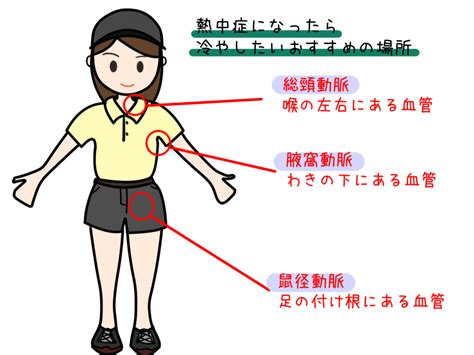 熱中症になったときの対処法は？冷やすべき場所はどこ？┃飛衛門 飛衛門