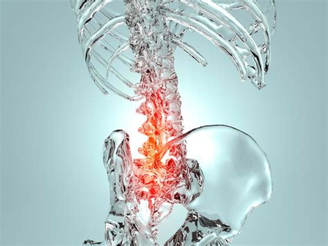 Premium Photo Illustration About Human Osteomyelitis Medical