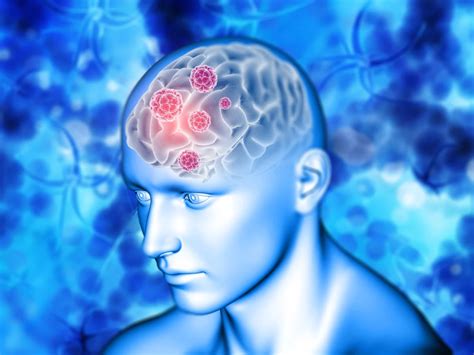 Can Brain Tumors Cause Depression Examining 4 Surprising Factors