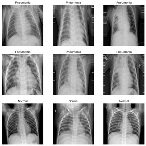 x ray pneumonia classification final notebook ipynb at main · 281clo x