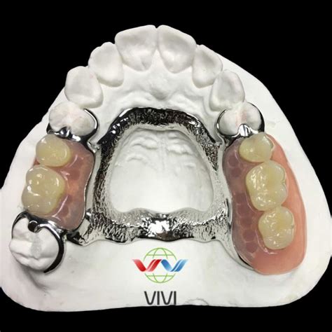 중국 캐스트 부분 틀니 공급 업체 공장 좋은 가격 Vivi Dental Lab