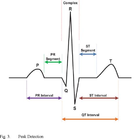 Figure 3 From Anomaly Detection In Cardiac Related Datasets Semantic Scholar