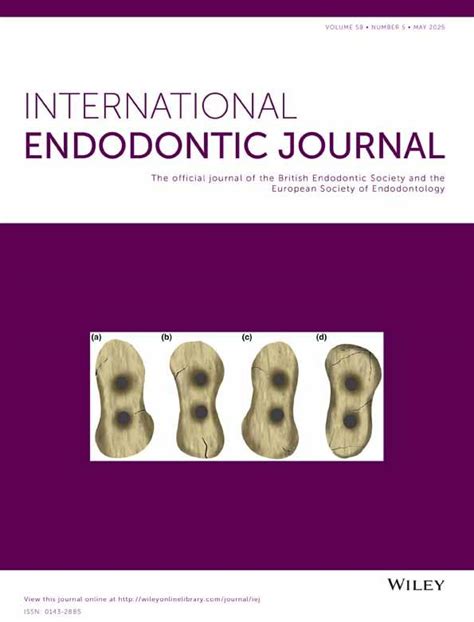 Paul Dummer On Linkedin International Endodontic Journal Bes