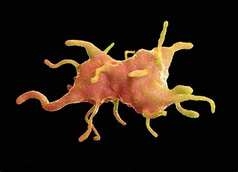 Amoeba Infections That Cause Brain Disease