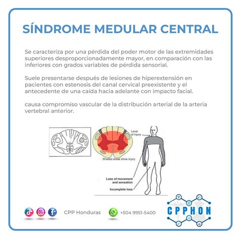 Cpp Honduras El Síndrome Medular Central Está Presente Facebook