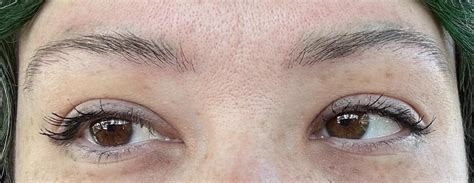 196 Best R Microbladingremoval Images On Pholder One Week Post Laser Daily Photo Collage