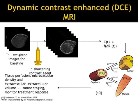 Introduction To Compressed Sensing Mri Pdf
