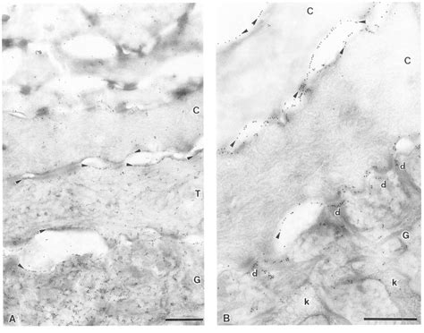 Immunoelectron Microscopic Analysis Of Cornified Cell Envelope