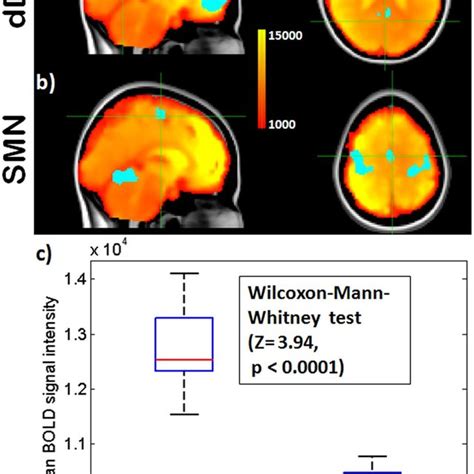 Fmri Bold Signal Within The Dmn And Non Dmn A Resting State Mean Download Scientific Diagram