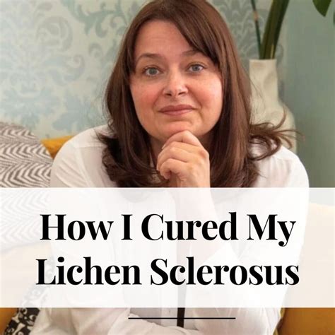 How I Cured My Lichen Sclerosus Elite Aesthetics Dr Shirin