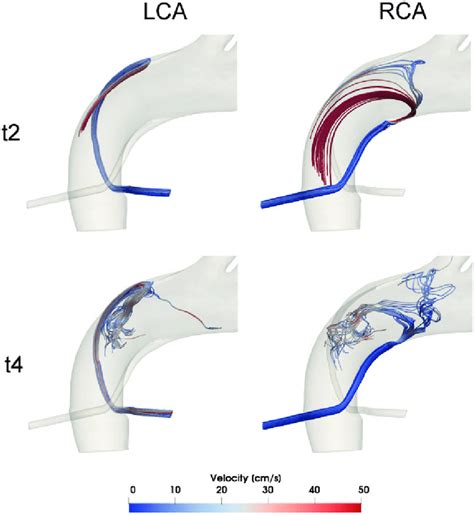 Results Of Computational Fluid Dynamics Simulations Streamlines Of