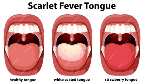 Tongue Anatomy Coloring Page