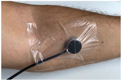 Towards A Miniaturized Photoacoustic Sensor For Transcutaneous Co2 Monitoring