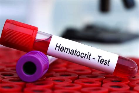 Hématocrite Élevée Causes Symptômes Et Solutions Pour Éviter Les