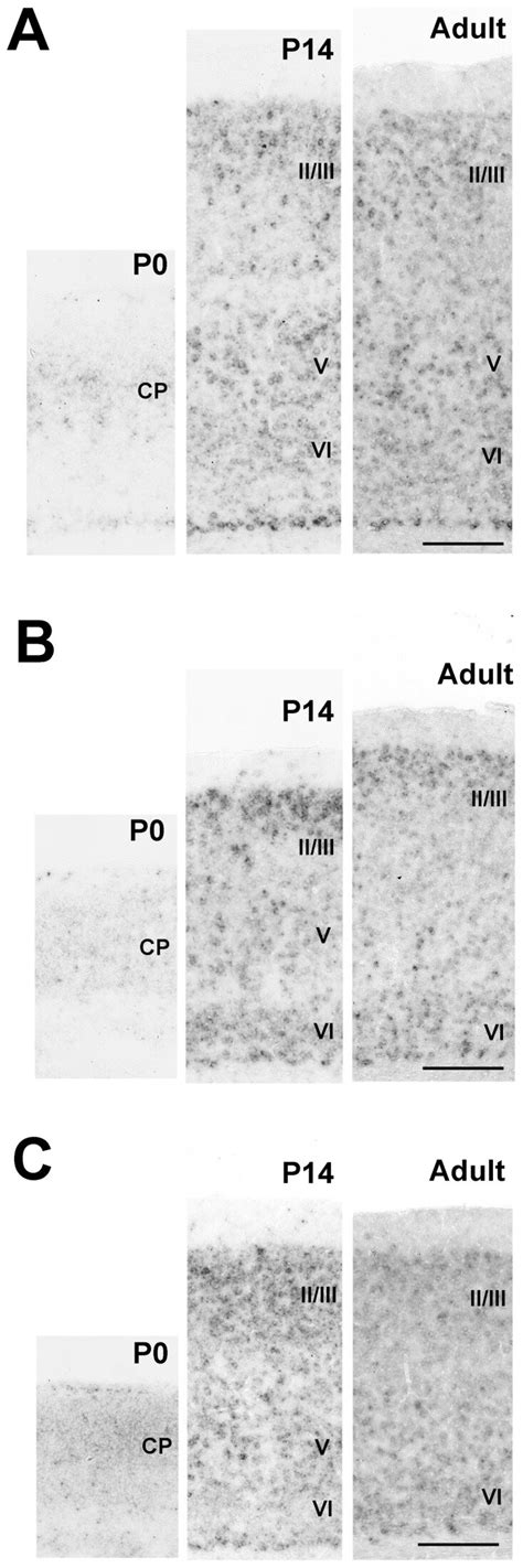 frontal cortex a auditory cortex b and visual cortex c in
